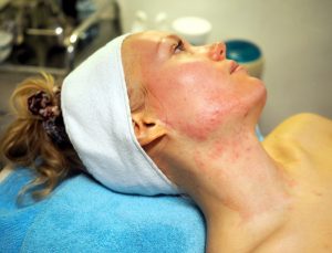 A bit of pain, lots of effectivity - A facial that brings me to tears
